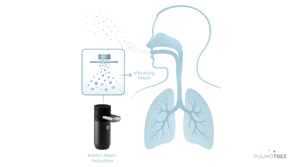 Nebulizing Biologics - Pulmotree Medical GmbH